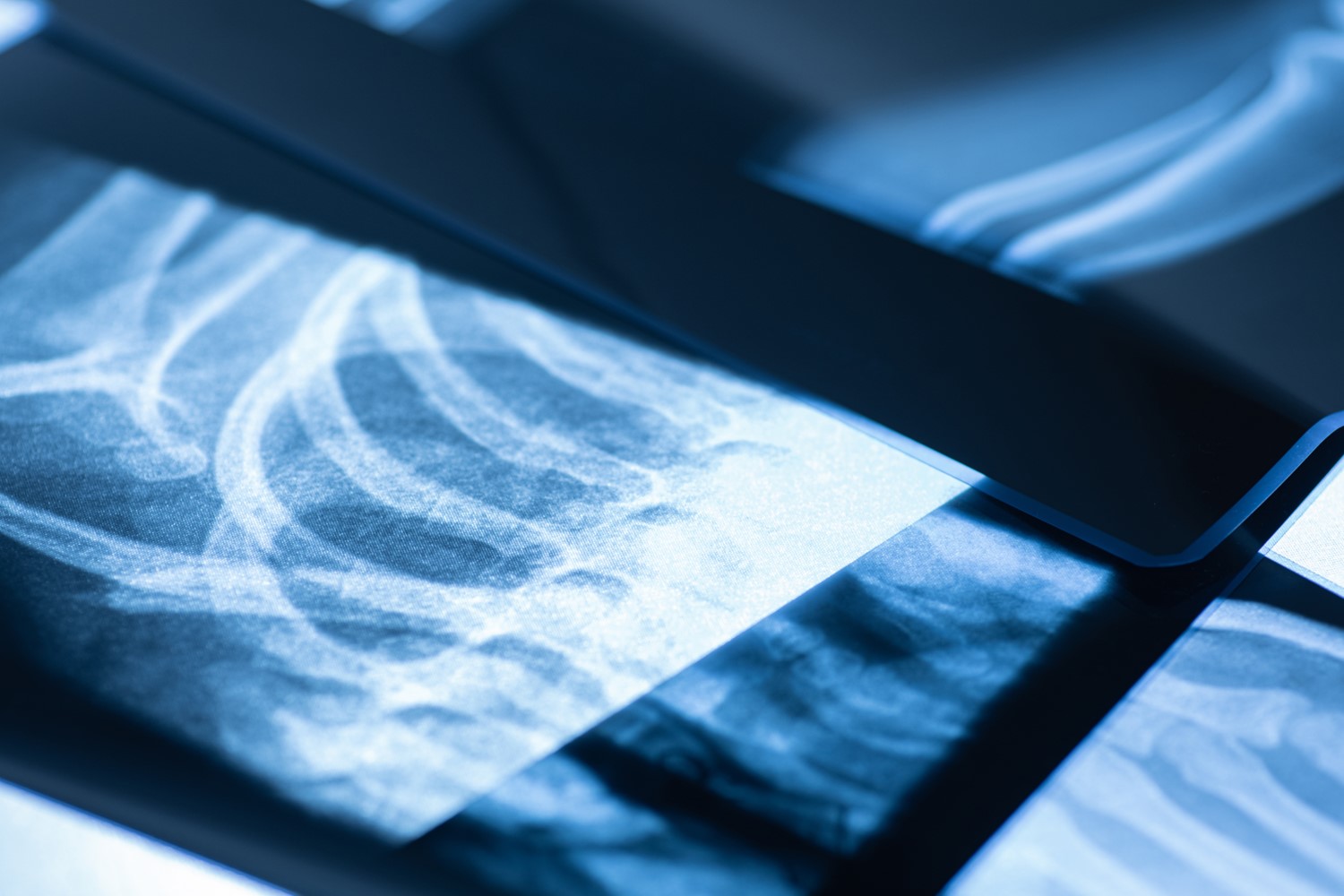 What Is a Chest CT Scan? - URS Medpoint